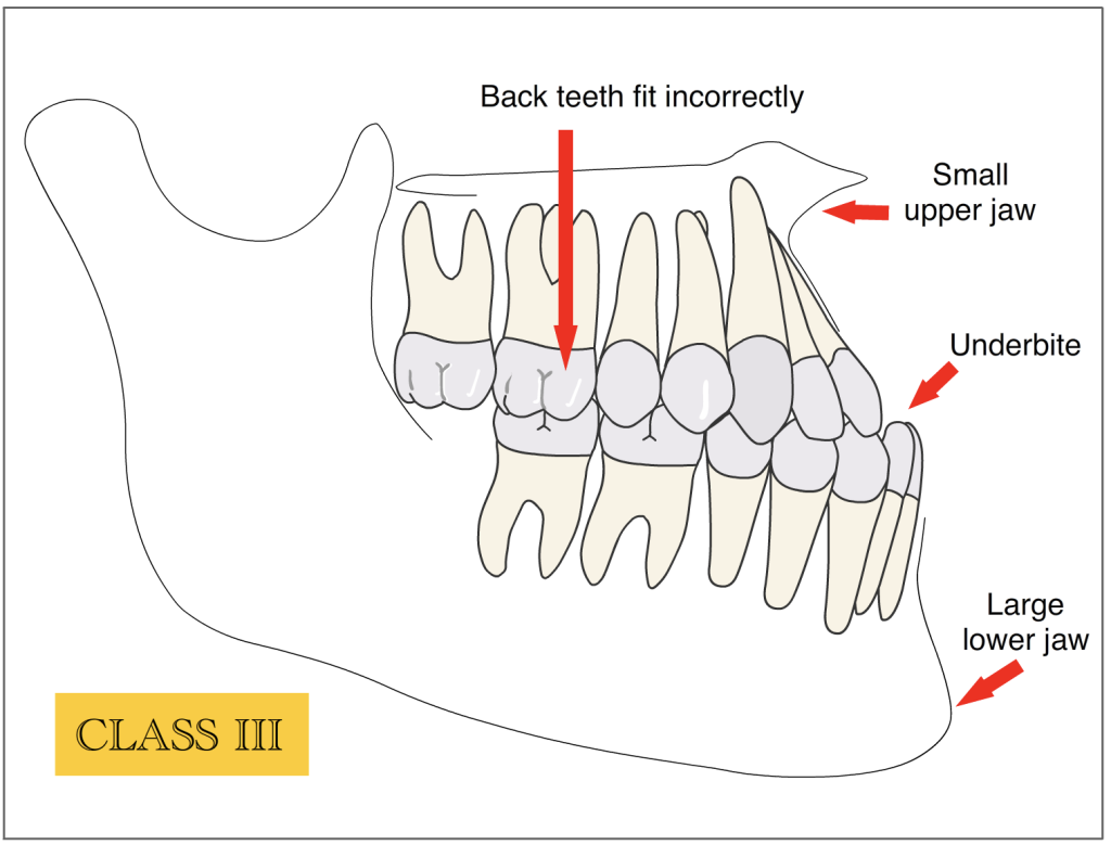 Orthodontics 101 – Helios Orthodontics