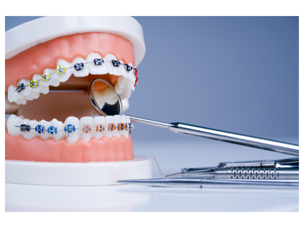What are the benefits of an orthodontic treatment ? – Helios Orthodontics